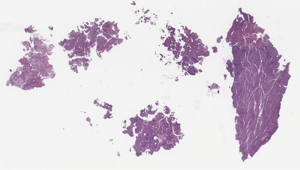 Digital Neuropathology @ Pitt